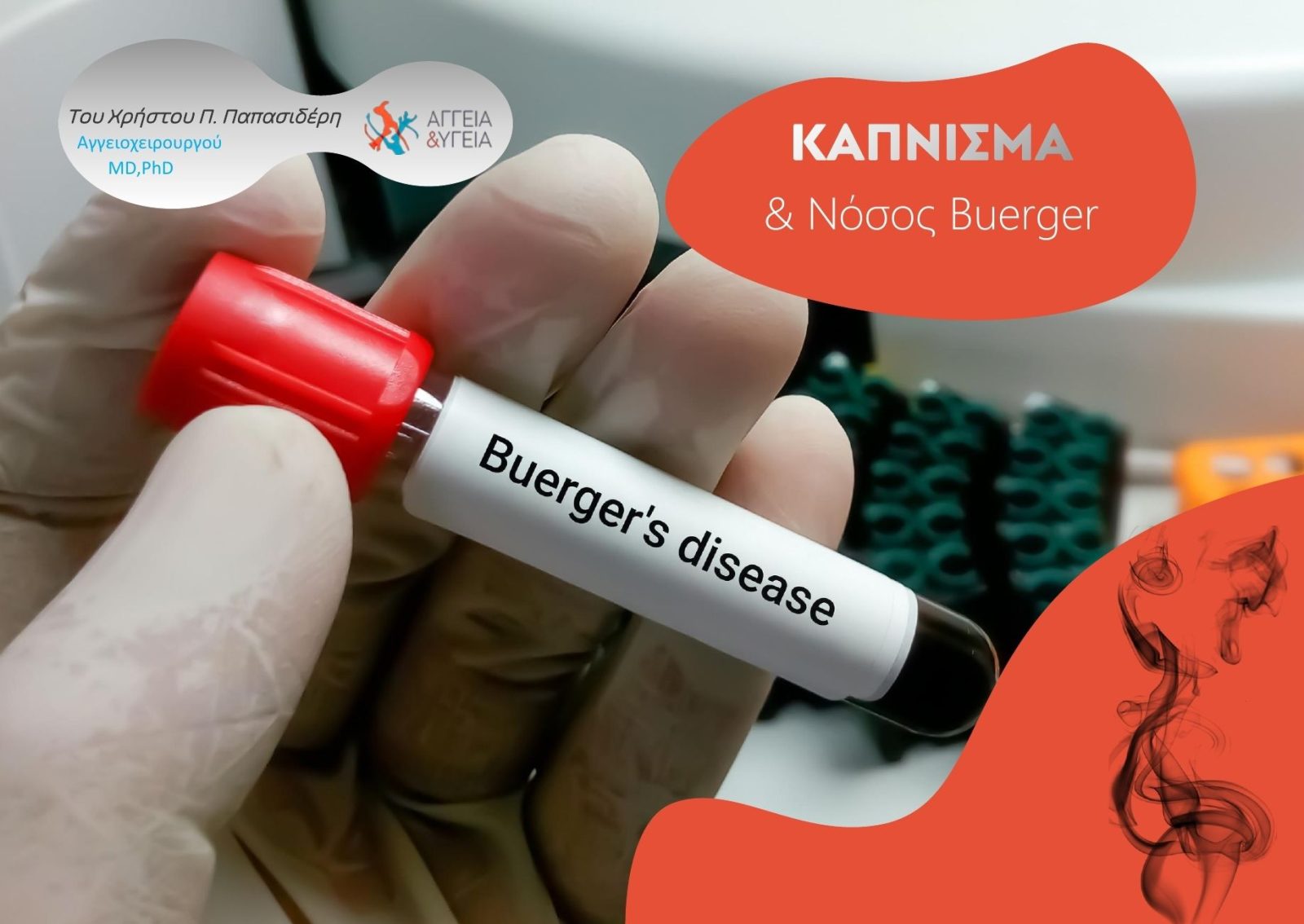 Νόσος Buerger & Κάπνισμα | Παπασιδέρης – Αγγειοχειρουργός MD, PhD